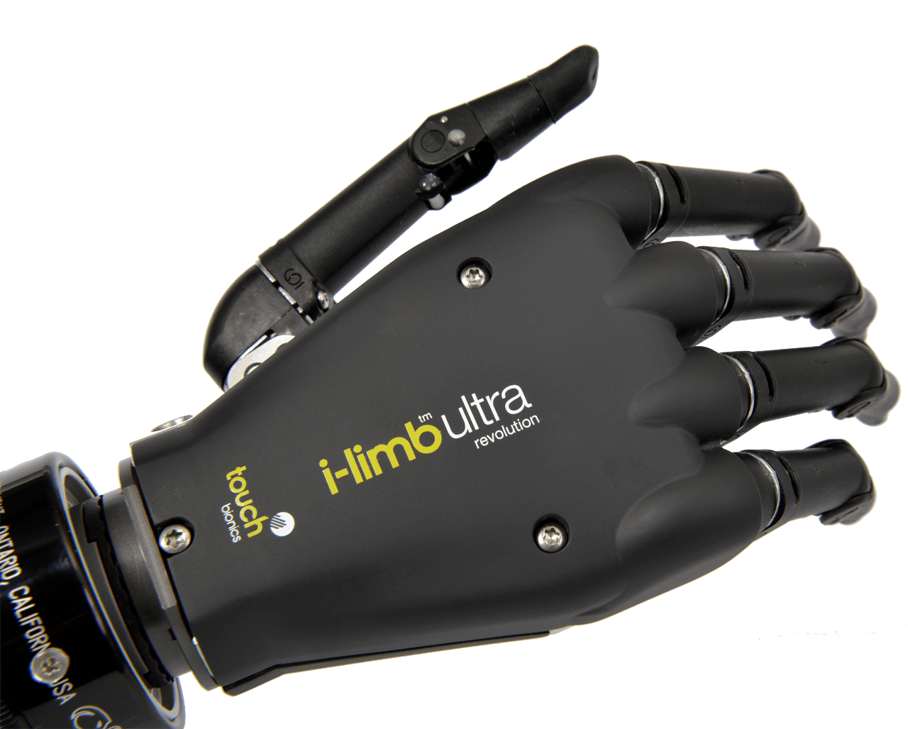 Man Gets Bionic Hands Controlled by the iPhone [Video] - iClarified