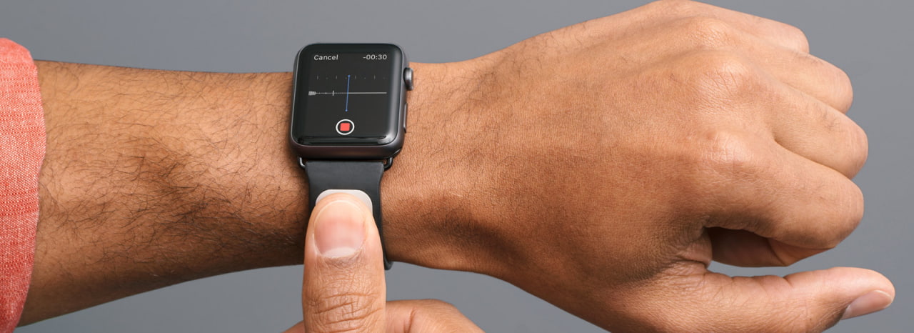 AliveCor Announces Medical-Grade EKG Band for Apple Watch [Video ...