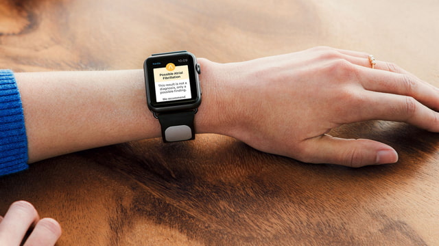 AliveCor Announces Medical-Grade EKG Band for Apple Watch [Video ...